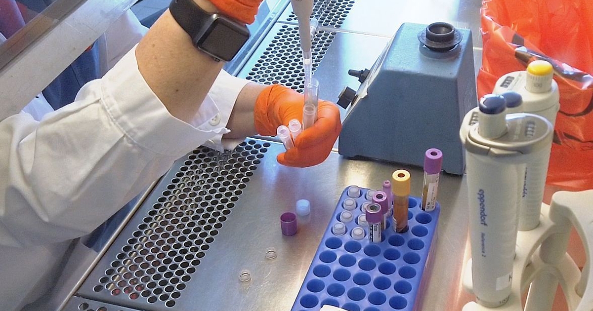 «Corona Immunitas»: Participation in Study - University of Lucerne